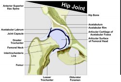 Total Hip Replacement - BJISG